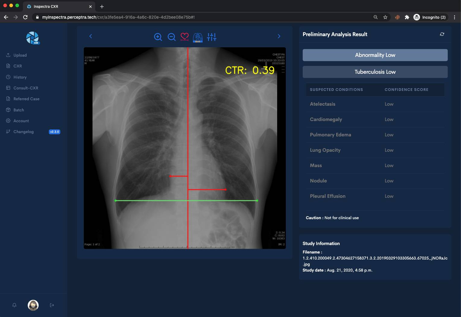 ฟีโบ้ มจธ. ร่วม บ.สตาร์ทอัพ ใช้ AI ปัญญาประดิษฐ์ช่วยตรวจจับโรคบนภาพ ...